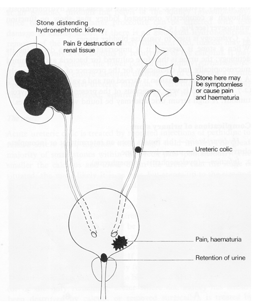 MT7 – Renal System – The Lewis College Hub